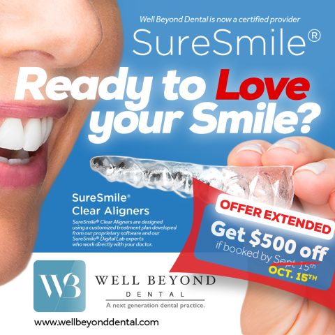 SureSmile Clear Aligners - Well Beyond Dental